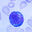 Patogeneza astmy. Neutrofil - Astma oskrzelowa - Cykle tematyczne ...